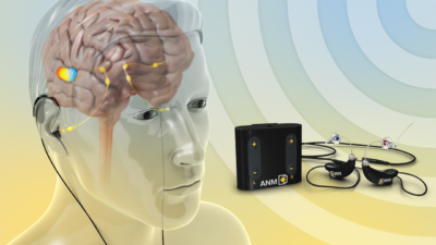 Acoustic Neuromodulation Animation - CAST PHARMA
