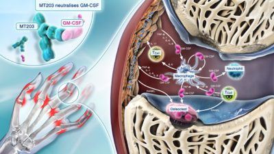 Medical illustrations, pharma infographics, and graphical abstracts ...